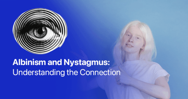 Horizontal Nystagmus: A Comprehensive Guide to This Involuntary Eye ...