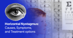 Downbeat Nystagmus: Understanding This Unique Eye Movement Disorder ...