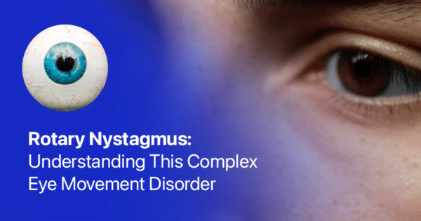 Horizontal Nystagmus: A Comprehensive Guide to This Involuntary Eye ...